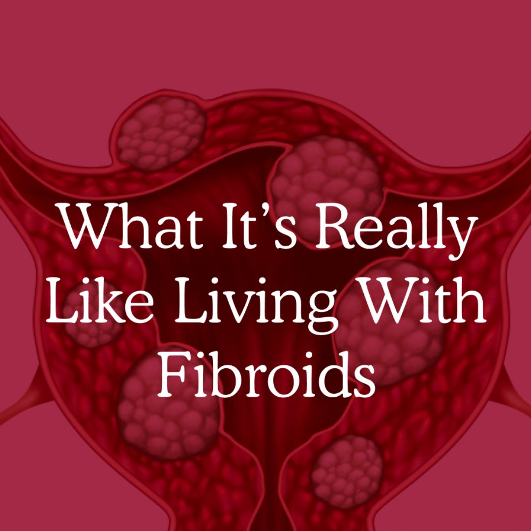 The Real Impact Of Fibroids – Myoovi